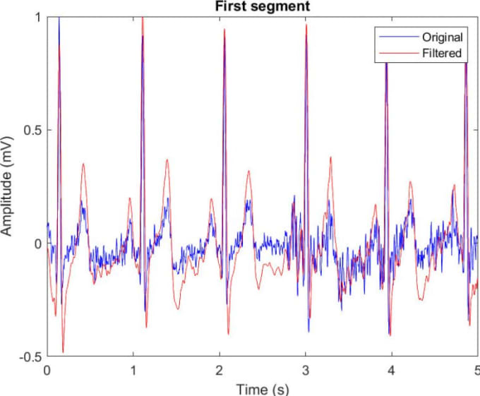 Do Biomedical Signals Eeg Emg Ecg Processing In Matlab By Prof Umairmalk4 Fiverr
