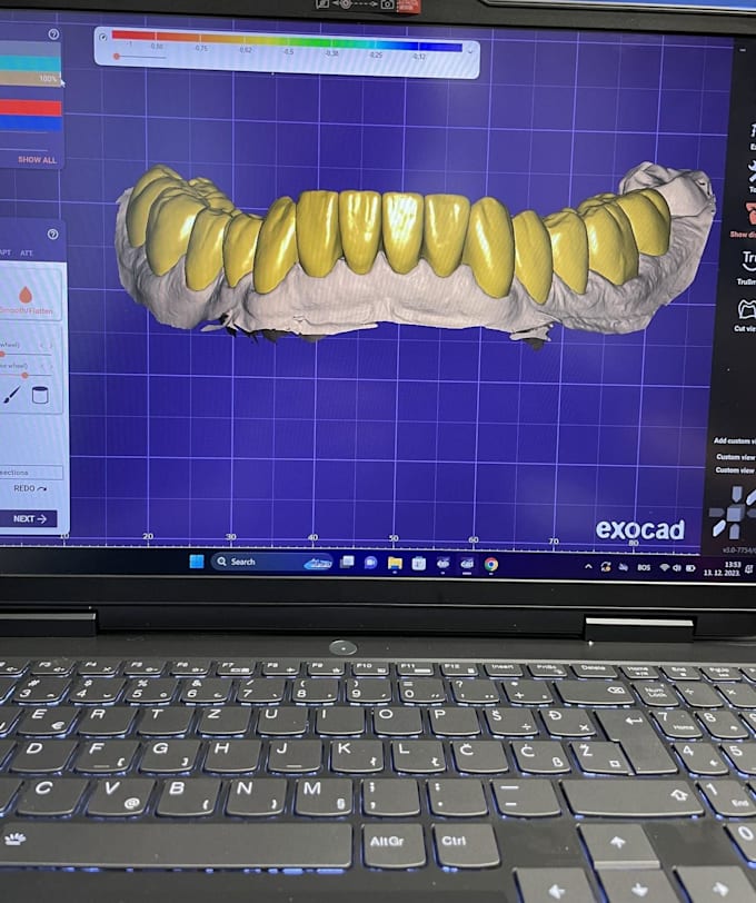 Exocad designer with 12 years of work experience, by Jelkoexocad | Fiverr