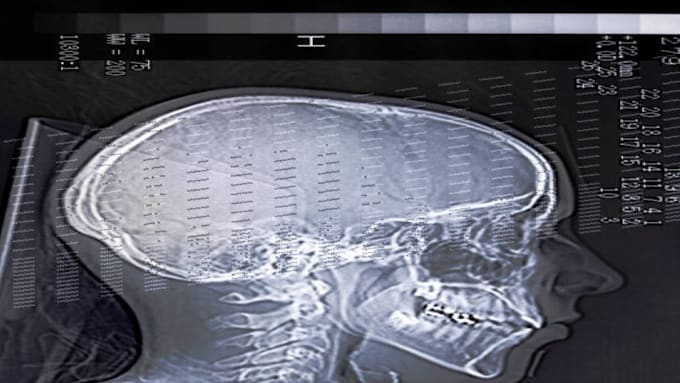 Provide Expert Mri Ct Scan Radiology Report Summarization By Hoorainfatima00 Fiverr