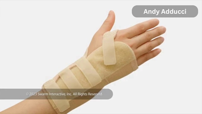 Offer 3d surgery animation, 3d ganglion cyst animation by Andy_mire ...