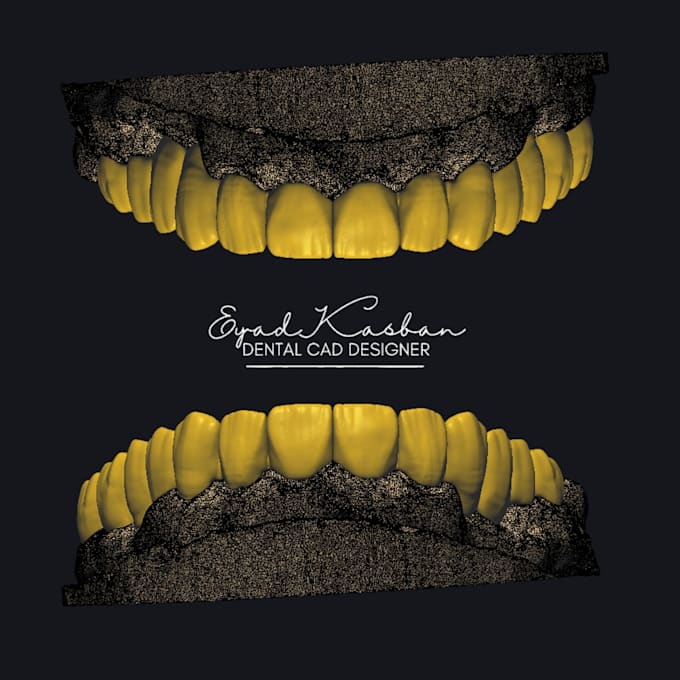 Design precise dental cad models using exocad by Eyadkasban | Fiverr