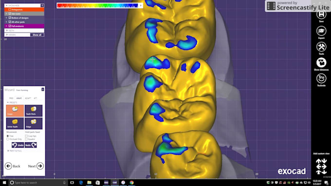 Execute exocad dental designs crowns and bridges by Translator2o1 | Fiverr