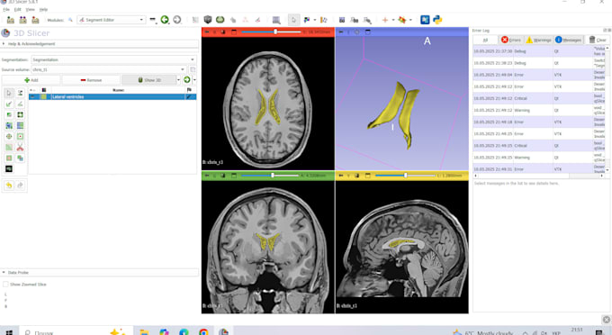 Segment anatomical structures from nifti dicom images using 3d slicer ...