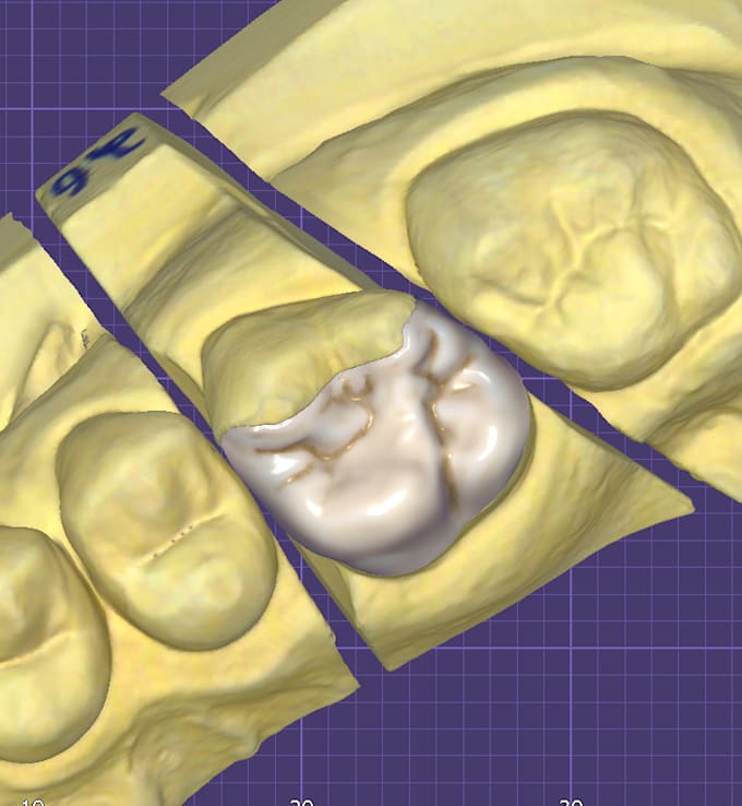 Digital smile design dsd, design high quality dental restorations with ...