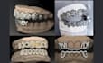 Design custom grillz and teeth 3d jewelry cad design, 3d grillz jewelry ...