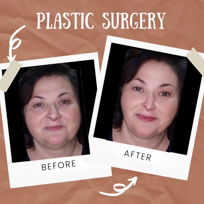 Do a plastic surgery photoshop to any part of your face by Sevenways777 ...