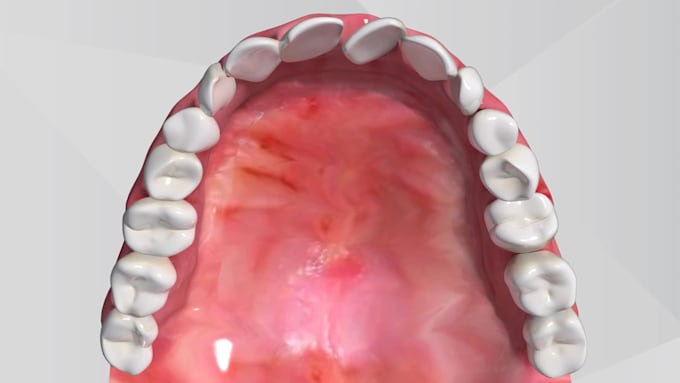 Create 3d medical animation, surgery animation, dental 3d animation ...