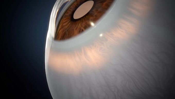 Render 3d scientific animation,surgery animation,3d medical animation ...