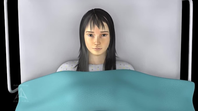 Create 3d medical animation, surgery animation, 3d medical video with ...