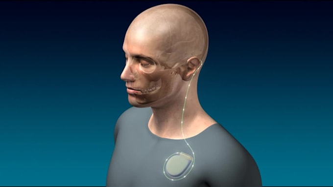 Do nursing awareness animation, disease, patient animation ...