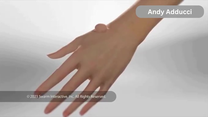 Offer 3d surgery animation, 3d ganglion cyst animation by Andy_mire ...