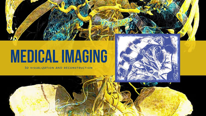 Visualization and processing of dicom format medical images by ...