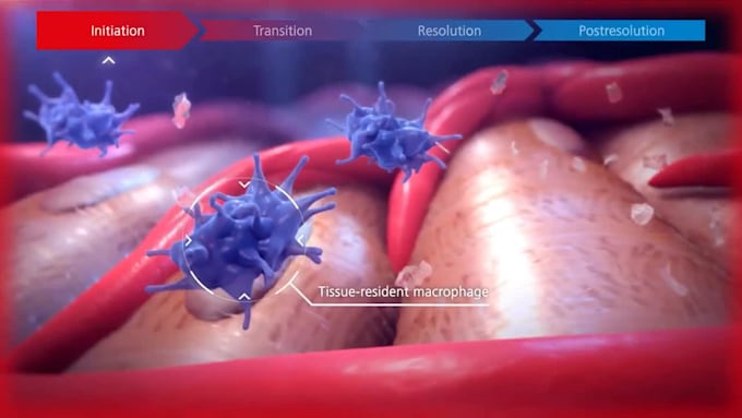 3d medical animation, medical explainer video, 3d product surgery ...