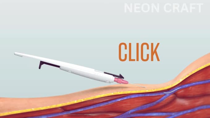 Do 3d medical device animation 3d surgical device animation medical ...