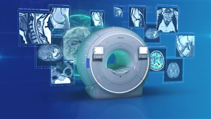 3d medical animation 3d surgical animation video 3d medical anatomy cgi ...