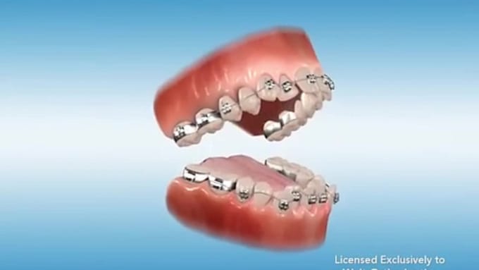 Do 3d surgical animation video 3d dental illustration 3d medical ...