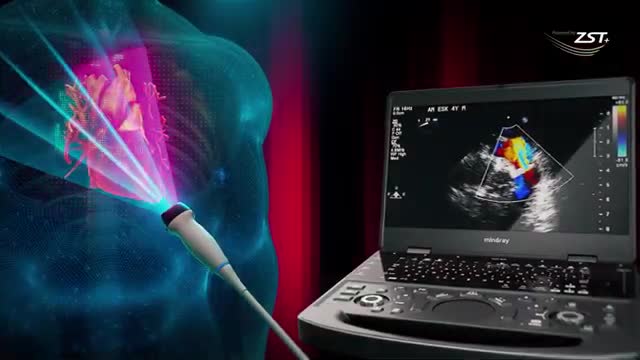 Create high quality 3d medical device animation 3d medical technology ...