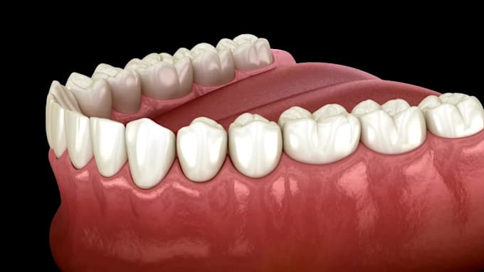 Create a premium dental video, 3d medical animation, surgery animation ...