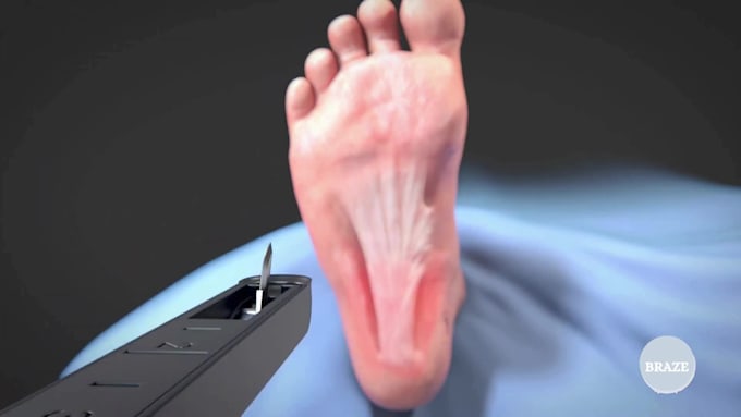 Create a realistic 3d medical animation, medical animation, surgery ...