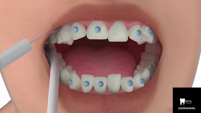 Create 3d medical animation 3d dental animation 3d surgery animation by ...