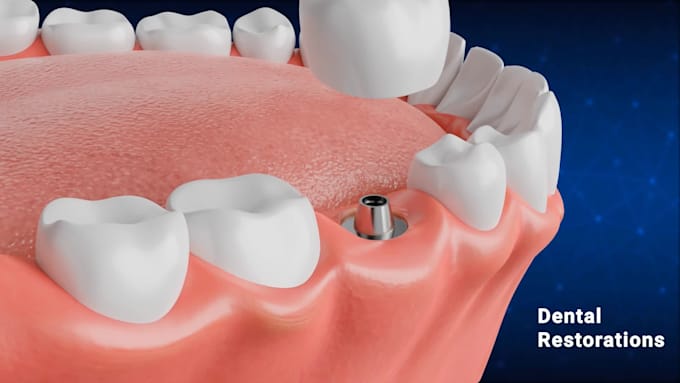 Create high realistic 3d medical animation, dental medical animation by ...