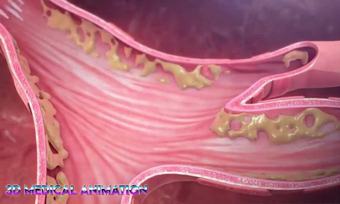 Create high quality 3d medical anatomy dental surgical procedure ...