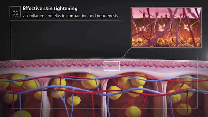 3d medical animation video 3d medical product animation medical ...