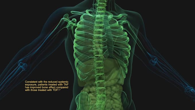 Do 3d medical animation 3d medical video surgery animation scientific ...