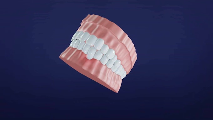 Do 3d medical animation 3d dental animation root canal 3d surgery ...