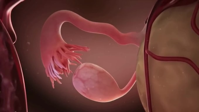 3d anatomy animation surgical procedure medical anatomy 3d explainer ...
