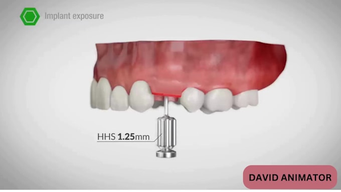 Create 3d medical animation, 3d surgical, orthodontic dental animation ...