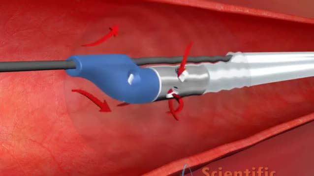 Medical animation 3d animation medical 3d medical animation surgery by ...