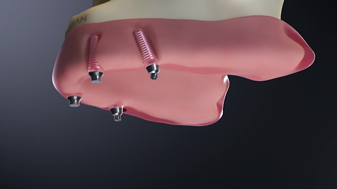 Create realistic 3d medical animation and anatomical procedure video by ...