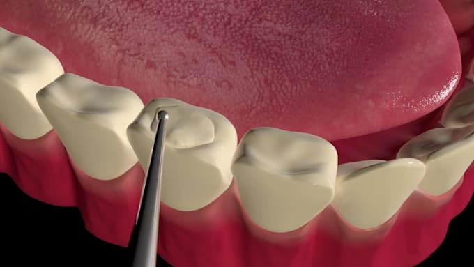 Create high quality 3d medical animation, 3d dental animation, 3d ...
