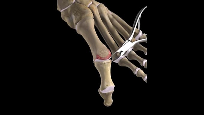 Create high quality 3d medical animation anatomy video medical ...