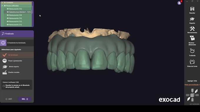 Make your design in exocad in less than 24 hours by Trinidad_exocad ...