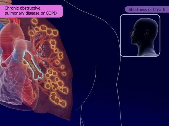 Create eye catching 2d explainer video for medical ,2d and 3d medical ...