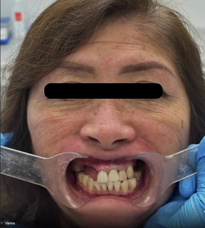 Professional digital smile design dsd by Cankilicaslan | Fiverr