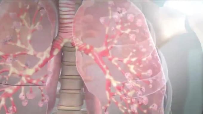 3d product animation video 3d medical animation video 3d medical ...