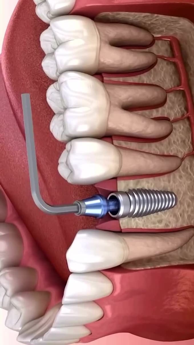 Do 3d dental animation 3d anatomy animation 3d medical video tooth ...