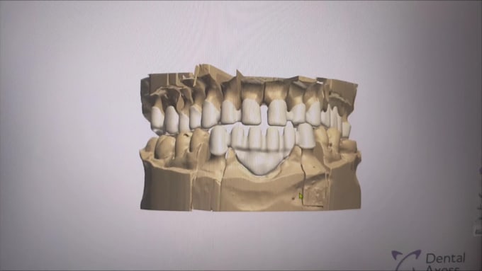 3d design teeth good and precise by Edin_husika13 | Fiverr