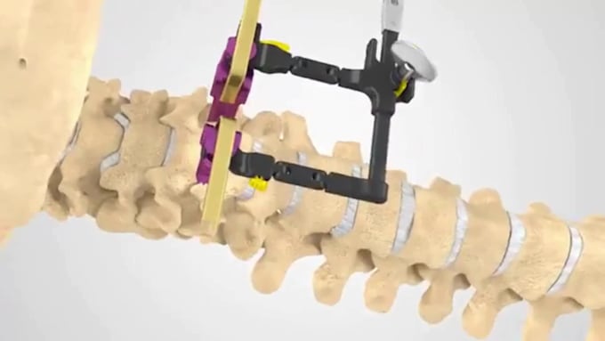 Create realistic 3d spine animation and orthopedic medical videos by ...
