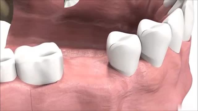 Create aesthetic 3d dental animation, 3d teeth animation, and 3d dental ...