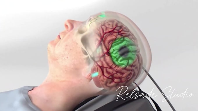 Do realistic 3d medical animation anatomy medical animated surgery ...