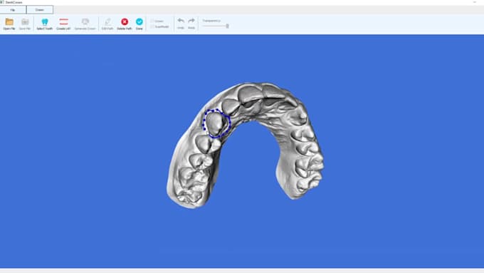 Develop your orthodontic 3d software by Caddevspecialis | Fiverr