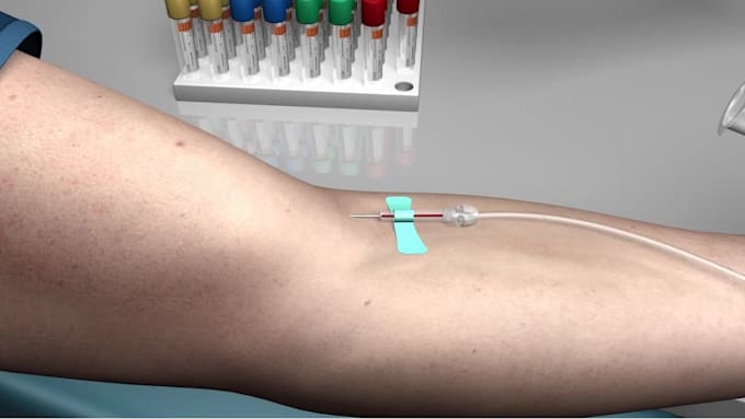 Create realistic 3d surgical animation for medical explainer videos by ...