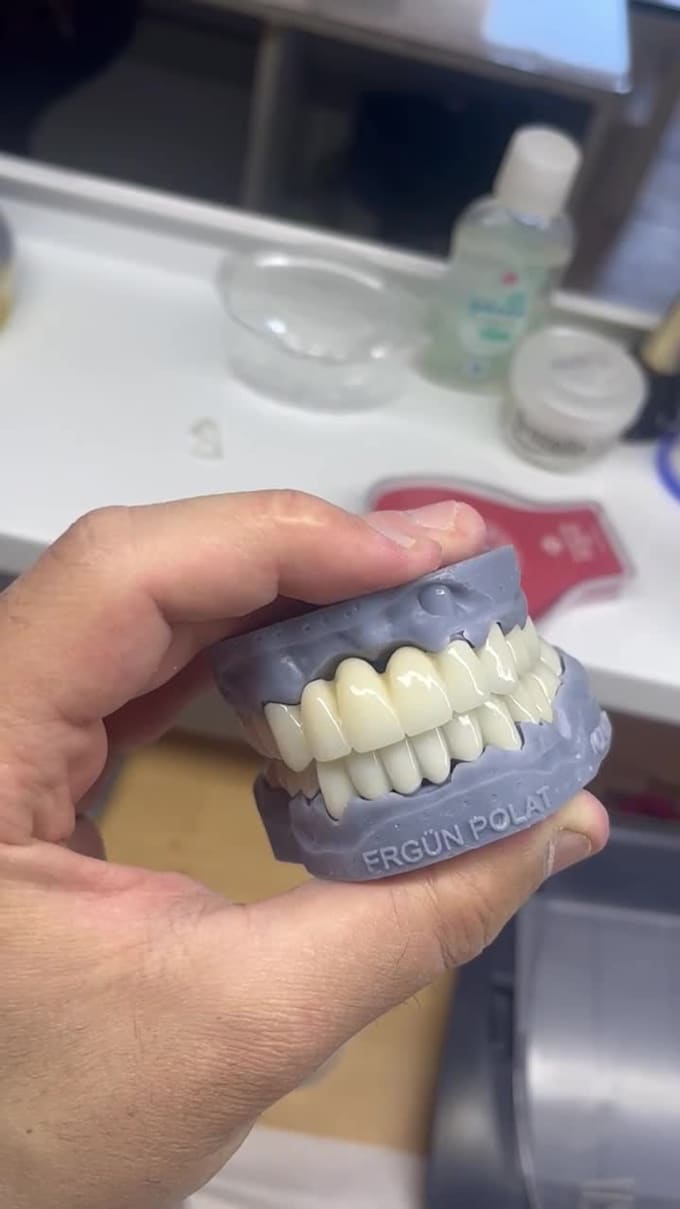 Design high quality crown in exocad by Canozerhuseyin | Fiverr