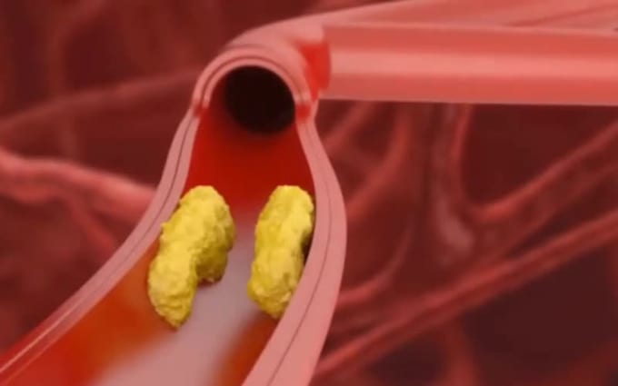 Medical anatomy modeling animation medical animation medical video ...