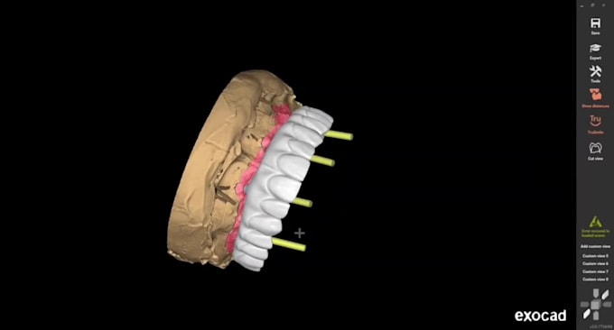 Exocad 3shape crown dentists bridges by Mitena1 | Fiverr