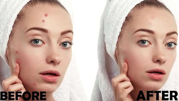 Remove wrinkles, pimples and retouch skin in photoshop by Puljansandisa ...